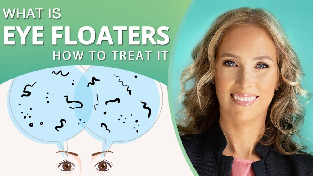 What Are Eye Floaters | How to Treat Eye Floaters Naturally | Dr. J9 ...